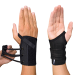 Handleds­distorsion (stukning av handleden)